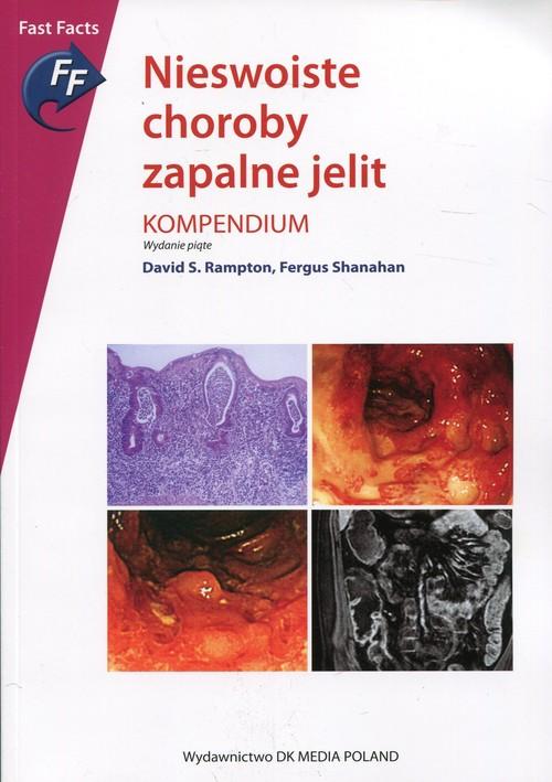 Nieswoiste choroby zapalne jelit Kompendium David S. Rampton, Fergus ...