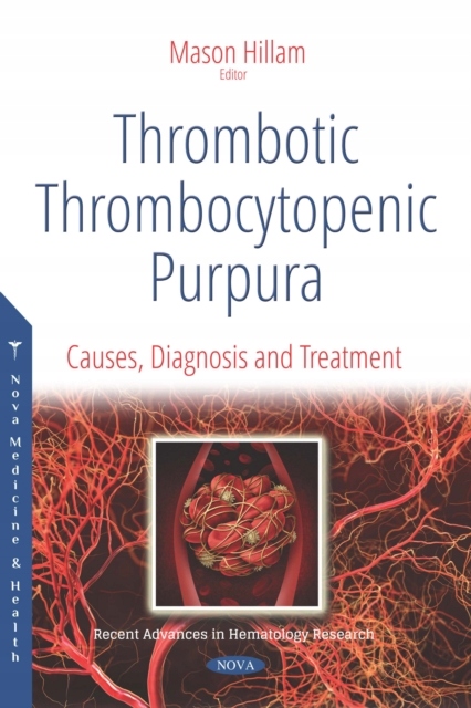 Thrombotic Thrombocytopenic Purpura: Causes, Diagn (9835630184) | Ebook ...
