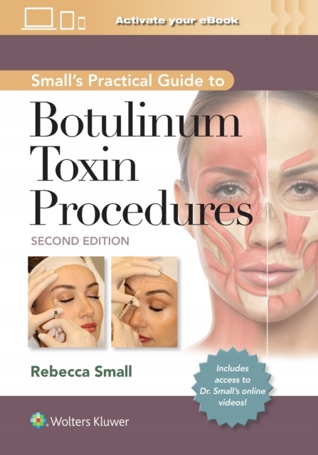 Smalls Practical Guide to Botulinum Toxin Procedures REBECCA SMALL ... Smalls Practical Guide to Botulinum Toxin Procedures REBECCA SMALL ...