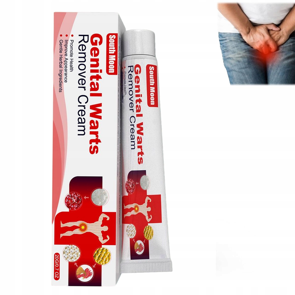 KRÉM NA OPAR OPARKY, BRADAVICE NA GENITÁLIÍCH 20 ML, (6900333721303 ...