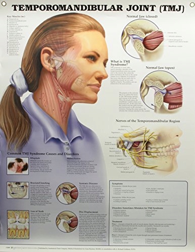 Anatomy Poster Temporomandibular Joint Disorders - Clinical Anatomy & Assessment Tmj Relief