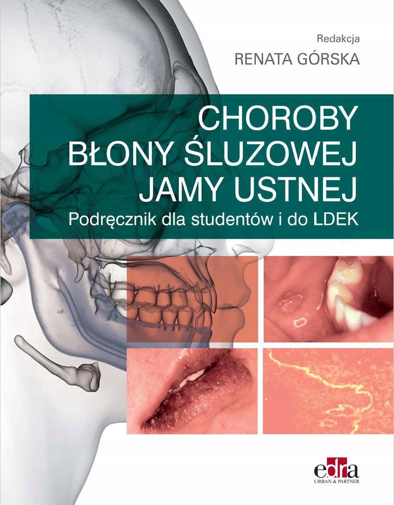 Choroby błony śluzowej jamy ustnej R. Górska • Cena, Opinie - Allegro
