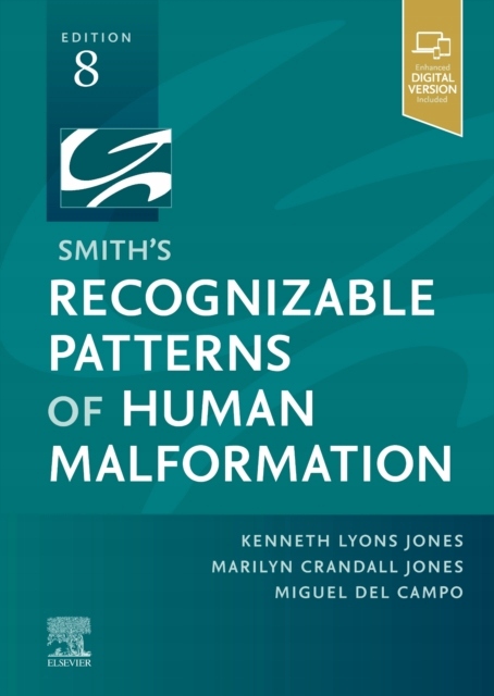Smith's Recognizable Patterns of Human Malformation (2021) Kenneth ...