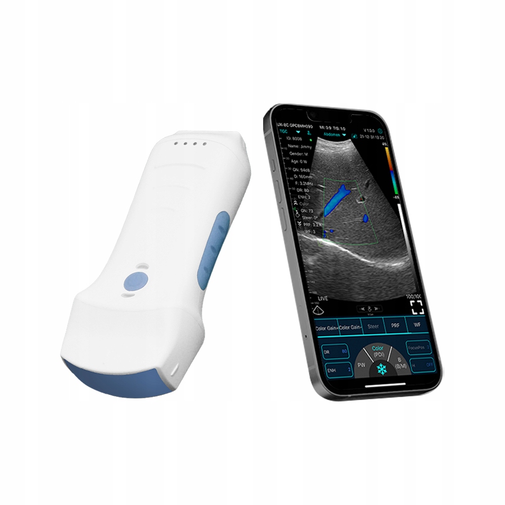 Przenośne Bezprzewodowe USG Ultrasonograf Color Doppler Linia Convex ...