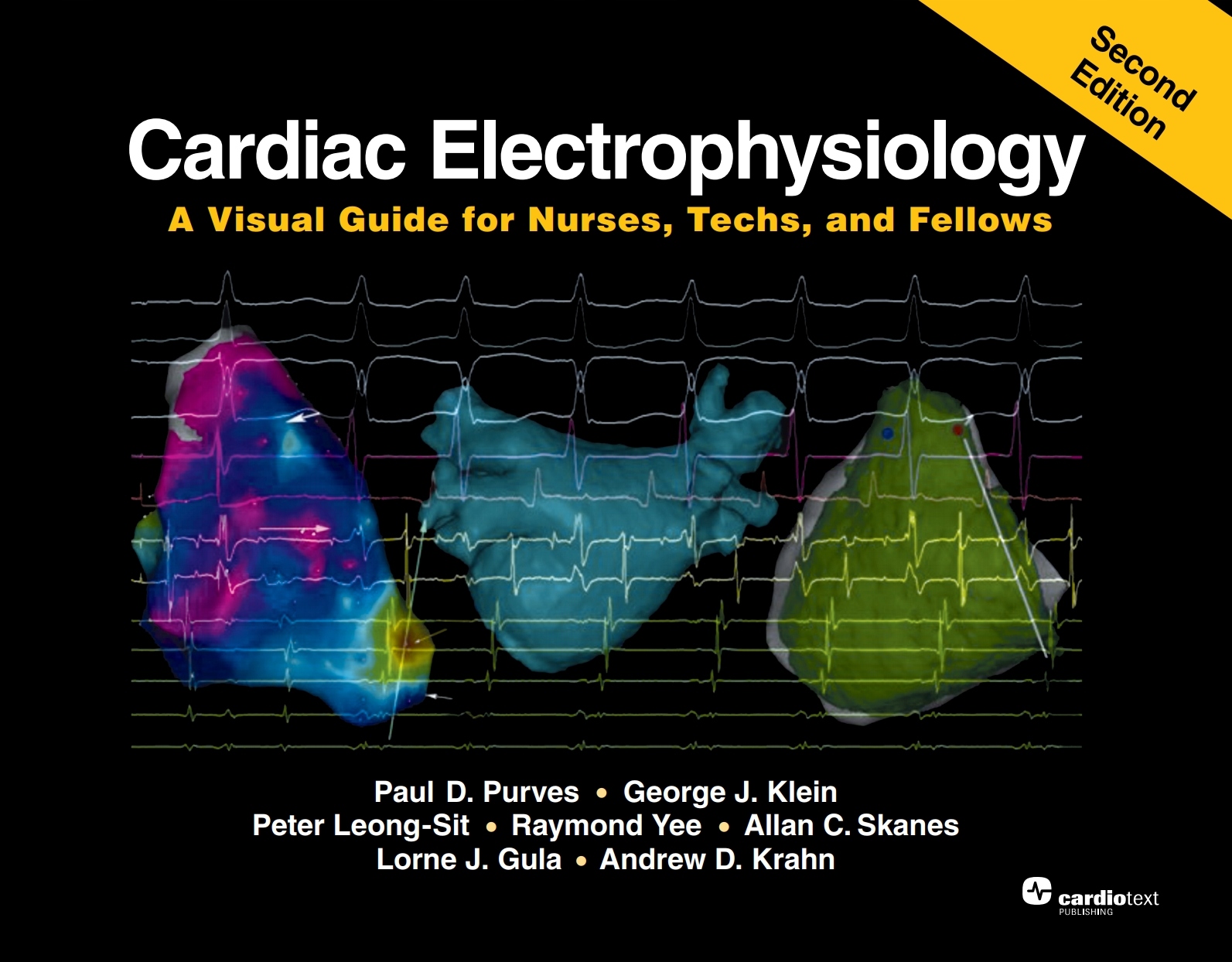 Cardiac Electrophysiology: A Visual Guide for Nurses, Techs, and ...