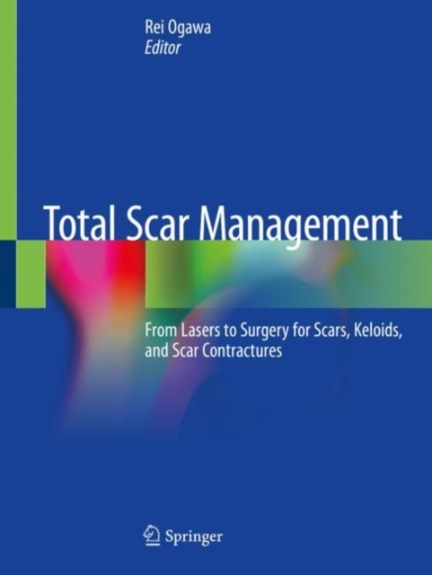 Total Scar Management: From Lasers to Surgery for Scars, Keloids, and ...