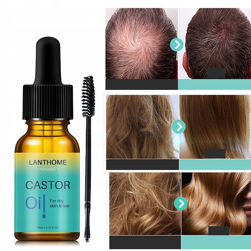 Sérum na růst vlasů s ricinovým olejem - Allegro