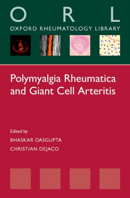 Polymyalgia Rheumatica and Giant Cell Arteritis (9666223708) | Ebook ...