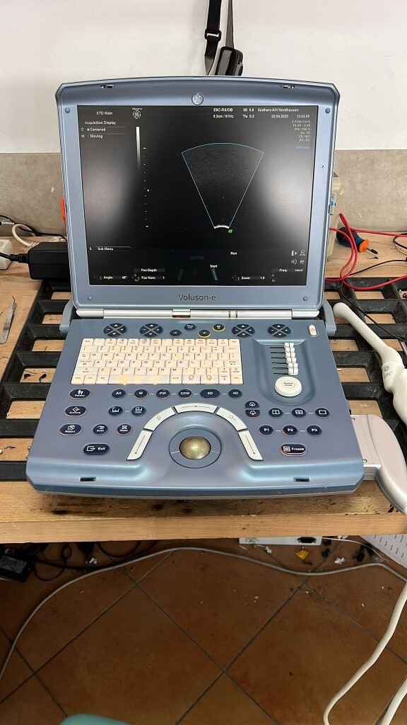 Voluson E | Gliwice | Kup teraz na Allegro Lokalnie