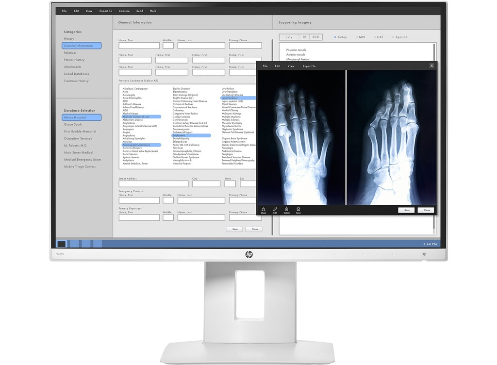 HP 24' IPS HC240 HEALTHCARE EDITION DICOM - 11977522776 - oficjalne ...