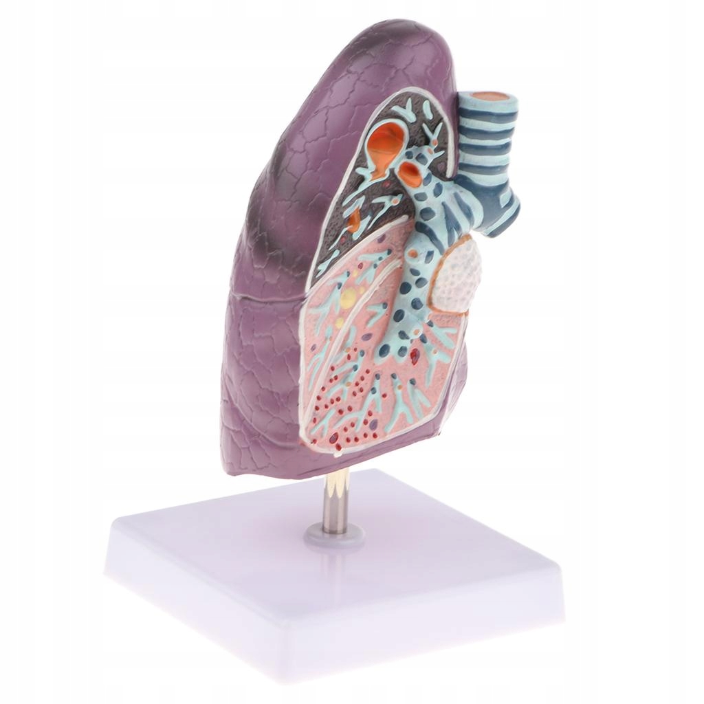 2:3 Human Diseased Lung Structure Respiratory System Model Kits Lab ...