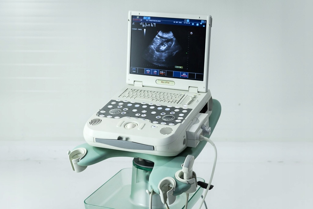 Esaote MyLab Five Przenośne USG Ultrasonograf - 12616082632 - oficjalne ...