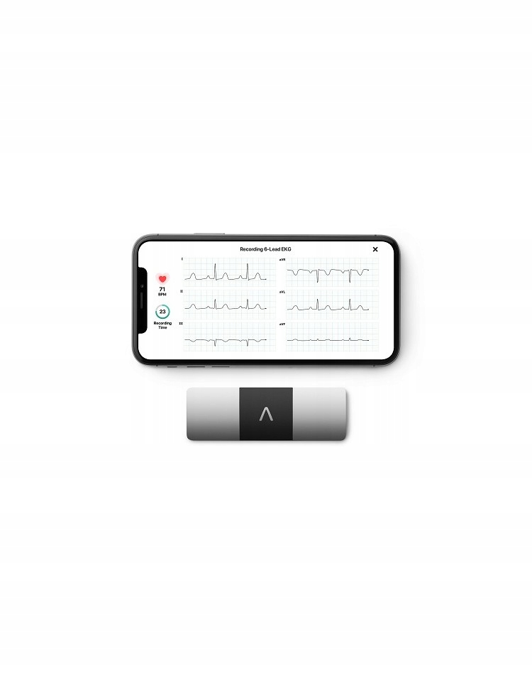 KARDIA MOBILE 6L AliveCor - 6-kanałowe mobilne EKG - 8457676037 ...