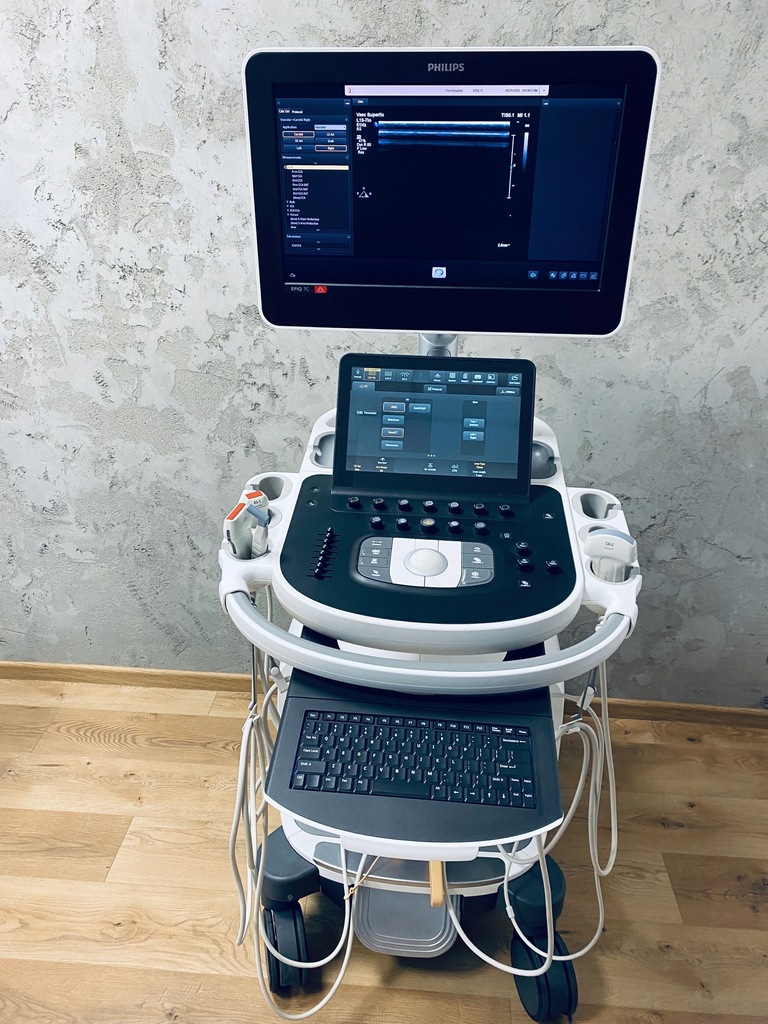 Aparat USG PHILIPS Epiq 7C z 4 głowicami - 12200933982 - oficjalne ...