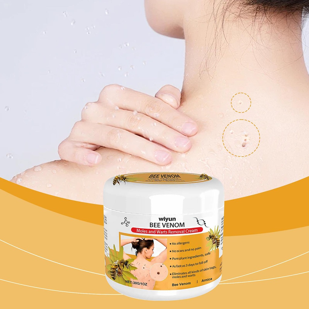 Lenaro Cream with bee venom for removing warts and moles, 30g - 16091939099 - oficjalne archiwum ...