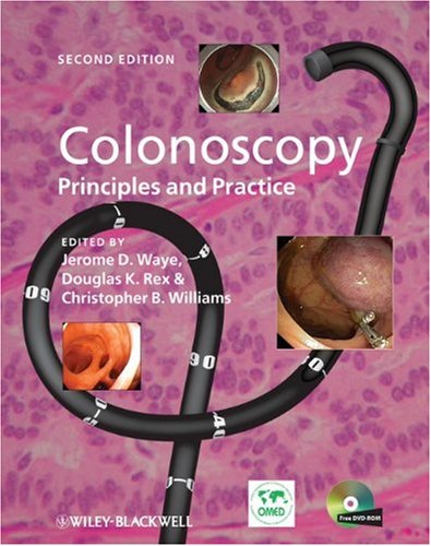 Colonoscopy: Principles and Practice Kolektív autorov, (9781405175999 ...