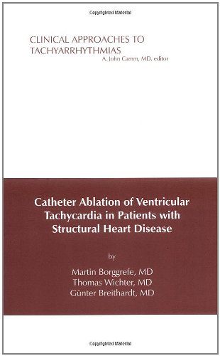 Catheter Ablation of Ventricular Tachycardia in (13856930038) | Książka ...